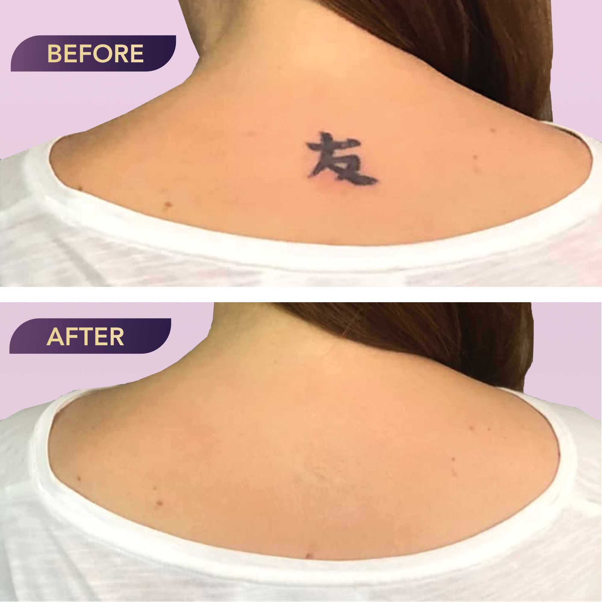 Tattoo Cover Up Concealer | Full Coverage Tattoo Makeup – Dermaflage Store